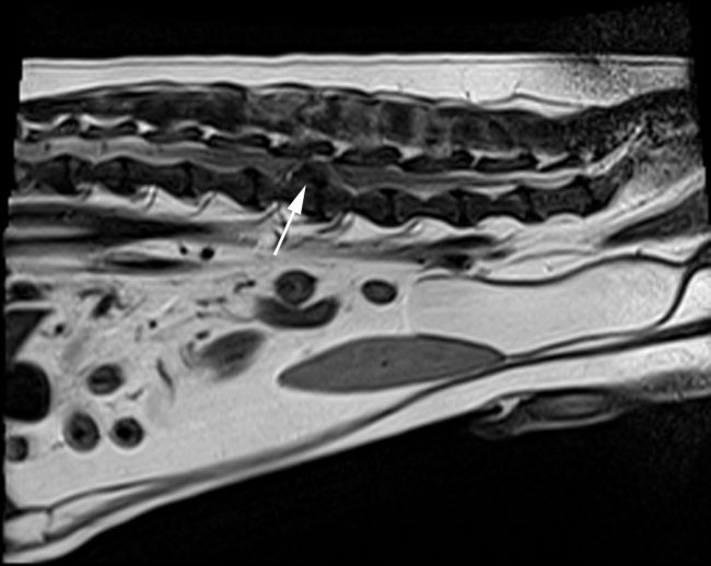 Case study: Surgery and rehabilitation for disc extrusion | College of ...
