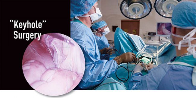 “Keyhole” Surgery | College of Veterinary Medicine at MSU